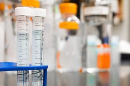 How to Do Heavy Metals Testing at Home and What it Means